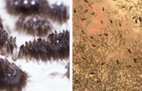 Understanding the Mosquito Lifecycle: A Guide to Prevention